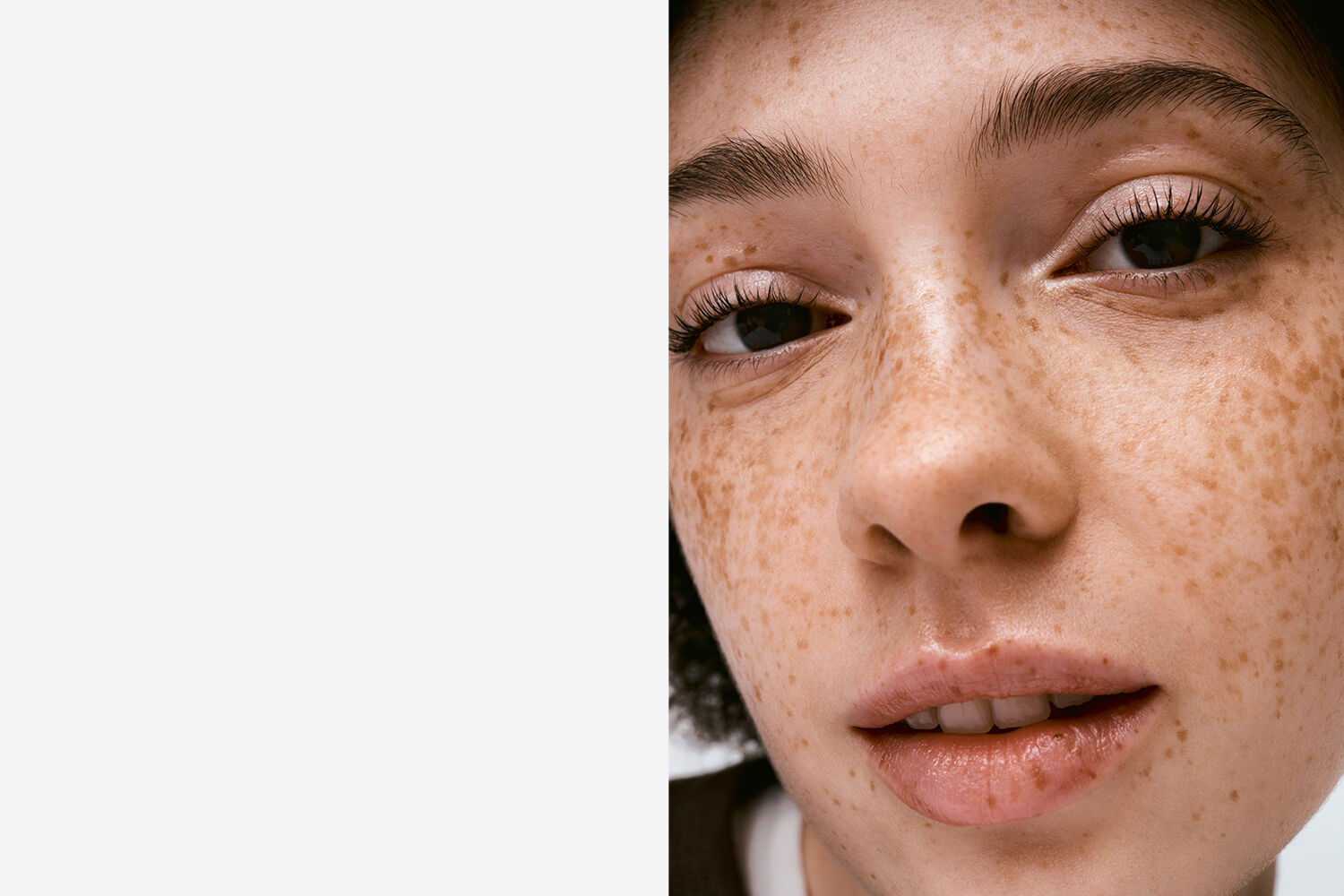 Marcas de Acné | Cetaphil® | Cetaphil CO